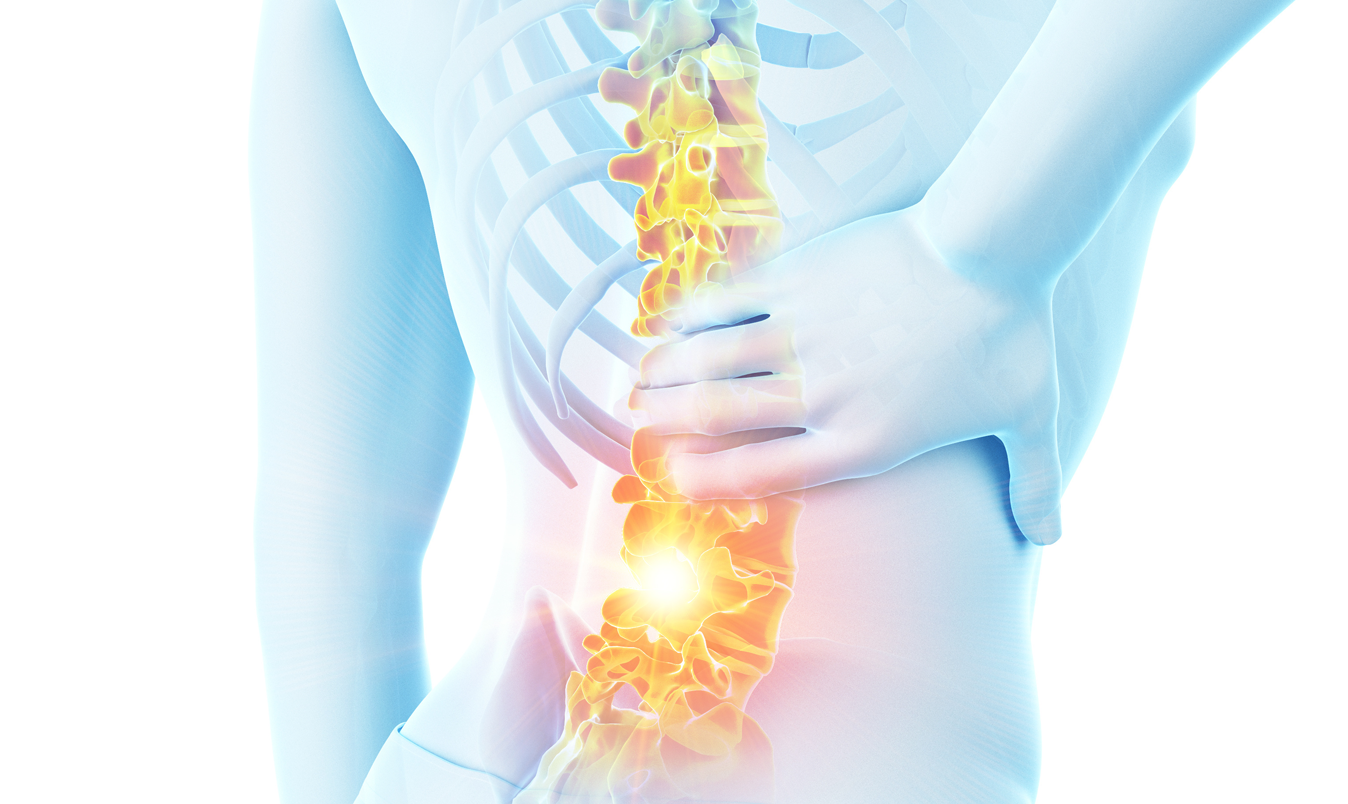 Conheça os tipos de lombalgia | Dr. Adriano Scaff